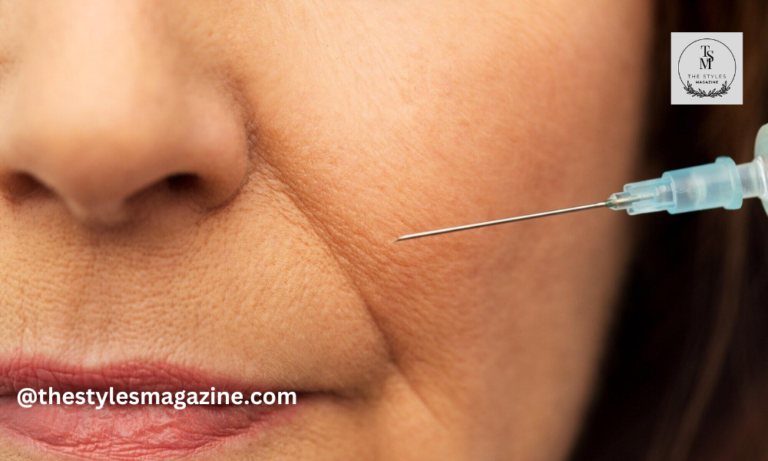 How Smile Line Botox Can Transform Your Look